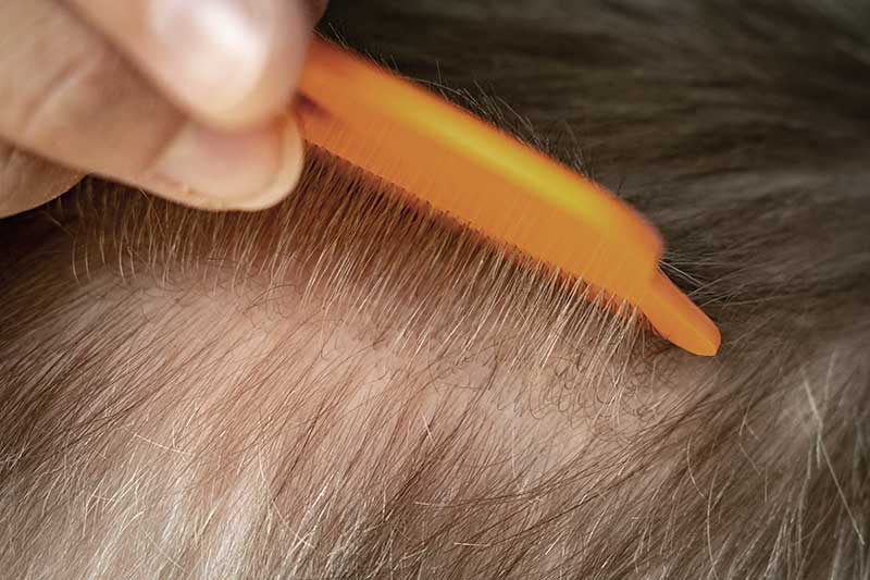 Läuse | Kinderaerzte Ingolstadt